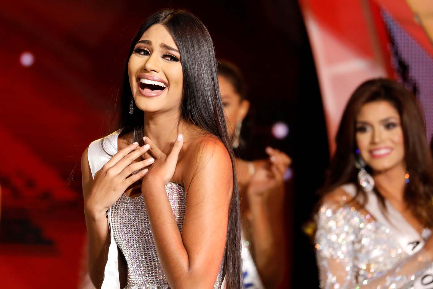 Avant et après chirurgie : Les photos de Miss Venezuela qui choquent ...