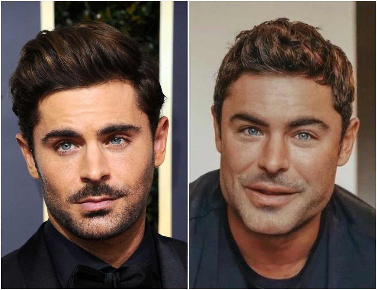 Zac Efron A T Il Abusé De La Chirurgie Esthétique Létonnante
