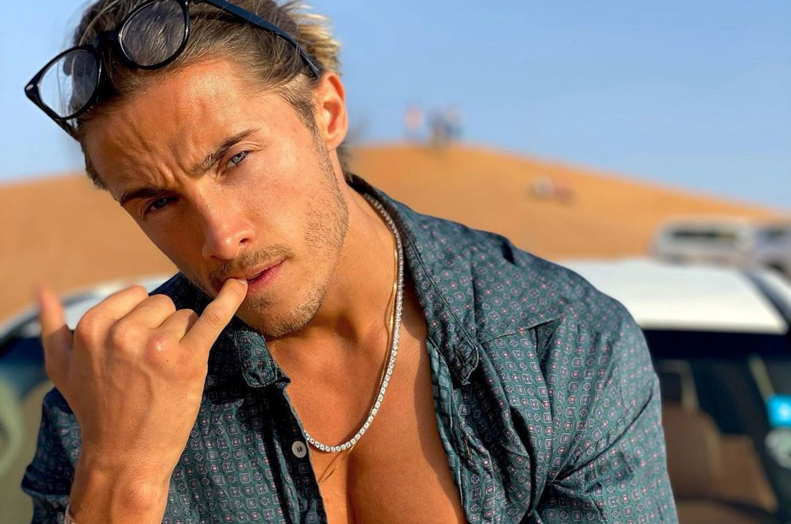 Dylan Thiry dévoile la somme dépensée en chirurgie esthétique et ...