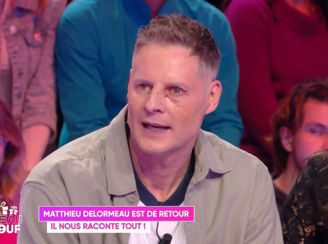 Tout beau tout n9uf : Matthieu Delormeau de retour le visage tuméfié ...